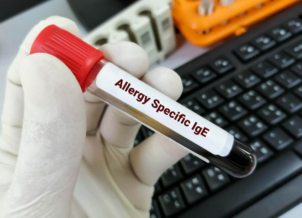 IgE过敏血液测试 | 尚至医疗